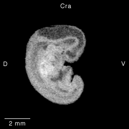 Multi-dimensional Human Embryo, Image/Animation Page