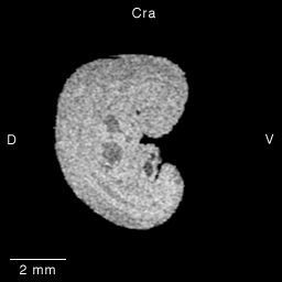 Multi-dimensional Human Embryo, Image/Animation Page